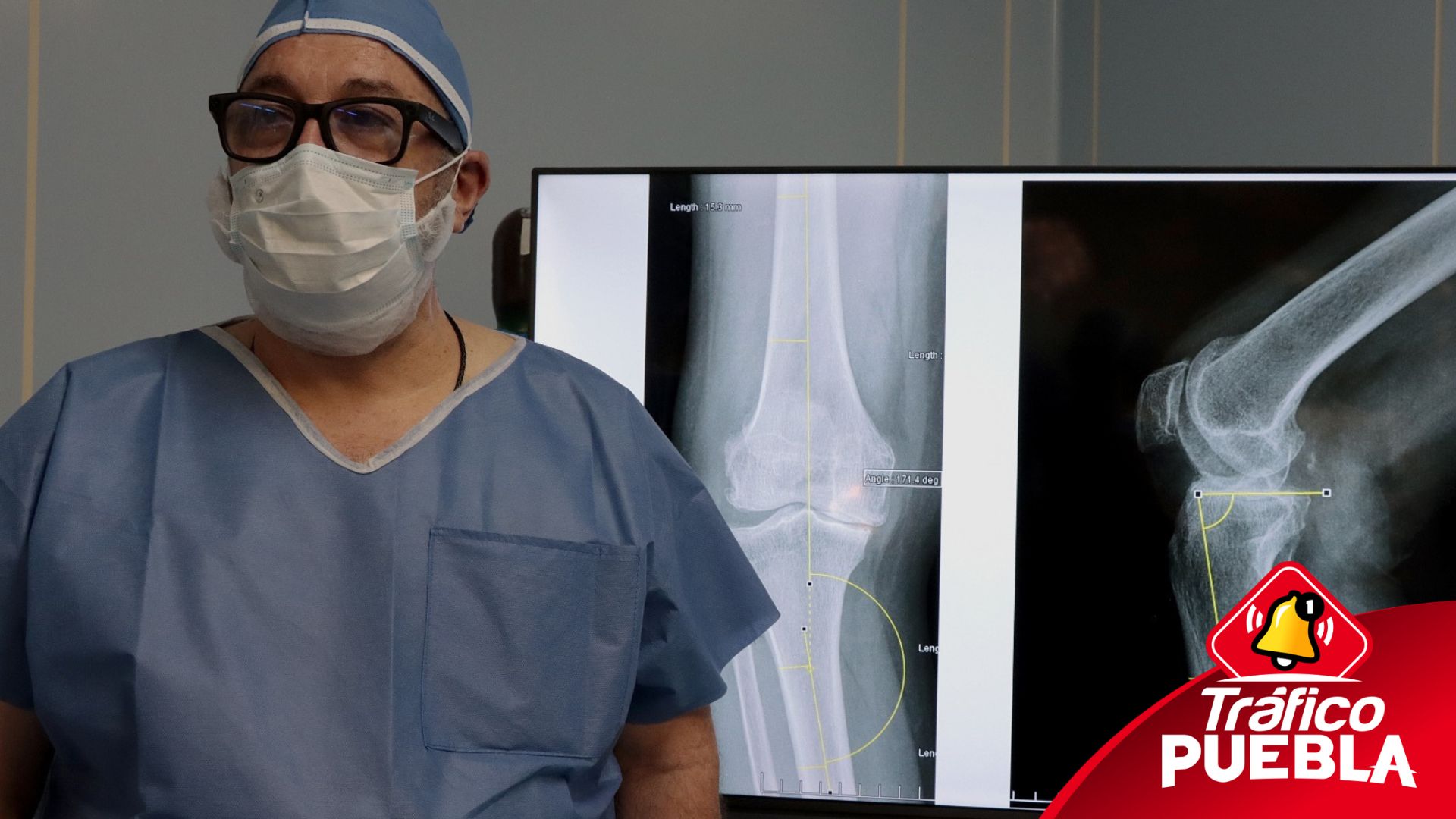 ISSSTEP realiza primera cirugía de rodilla asistida con inteligencia ...